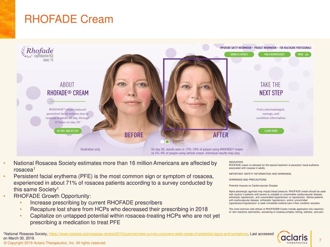 Aclaris Therapeutics (ACRS) Investor Presentation - Slideshow (NASDAQ ...